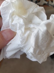 Help!!! Is this my mucus plug coming out? 32 weeks pregnant.picture ...