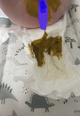 Is this normal baby poo? CMPA? Help Please | Mumsnet