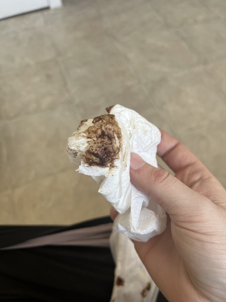Brown clot and blood at 11+4 | Mumsnet