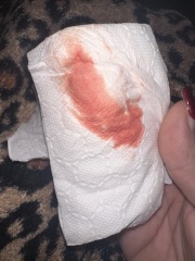 *Sensitive photos attached* 14DPO bleeding & positives tests | Mumsnet